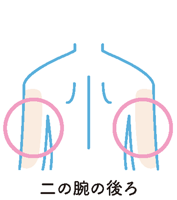 ナノゾラの投与方法｜ナノゾラによる治療を受ける患者さんとご家族の方へ